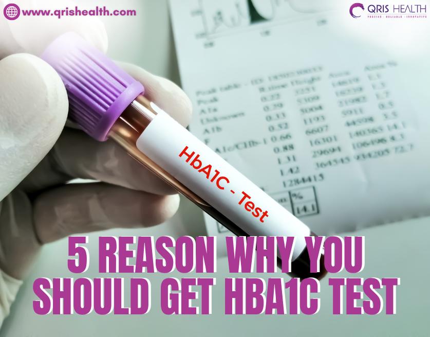 5 Reasons Why You Should Get an HbA1c Test Regularly